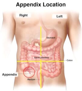 Appendicitis Types Causes Symptoms Treatment