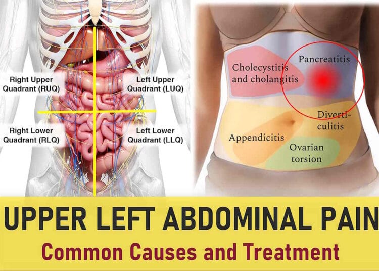 Lower Left Abdominal Pain: Common Causes and Treatment Lower Left Abdominal Pain: Common Causes and Treatment